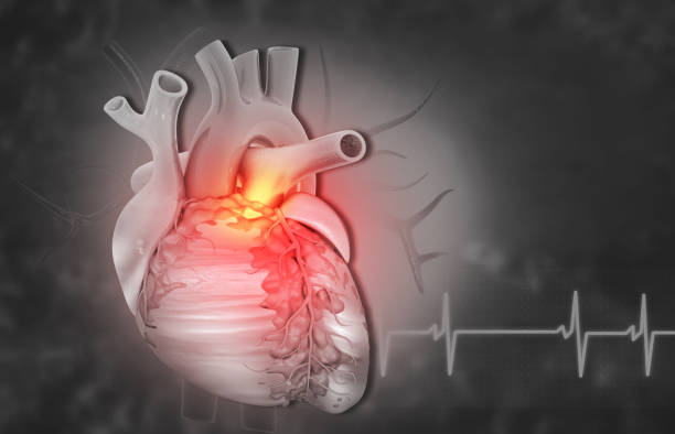 Todo lo que necesitas saber del Electrocardiograma (ECG) | Centro ...